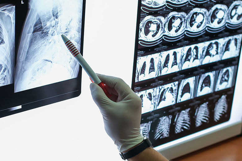 Prem Shekar, MD, Named Chair of Cardiac and Thoracic Surgery at Lahey ...